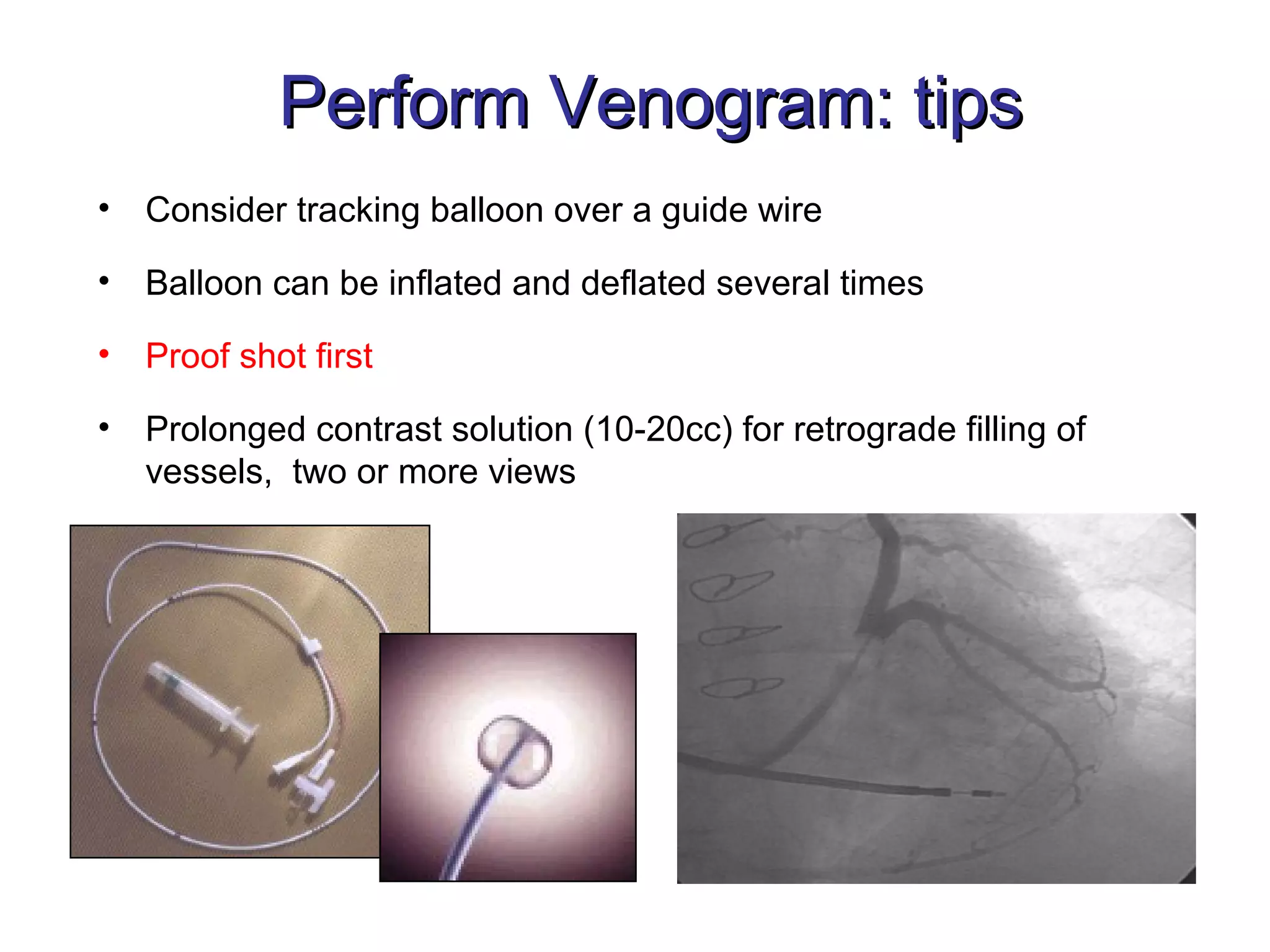 LV Lead Implantation Tools: Choices of LV Leads | PPT