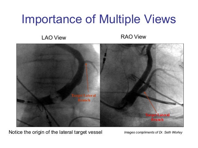 Lv Lead Position In Crt | semashow.com