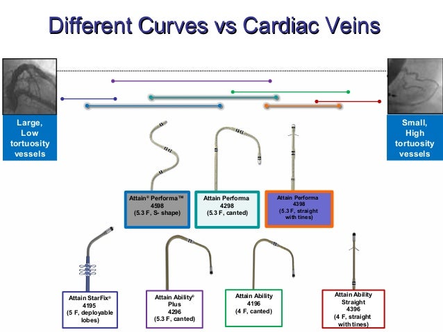 LV Lead Implantation Tools: Choices of LV Leads