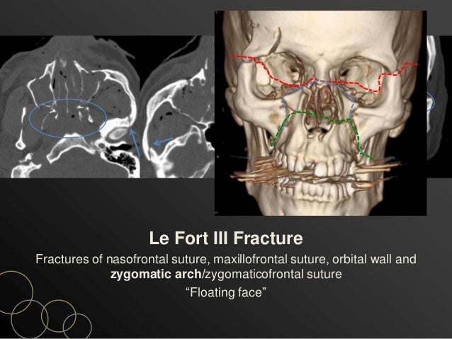 20160925 ser dr.rathachai kaewlai