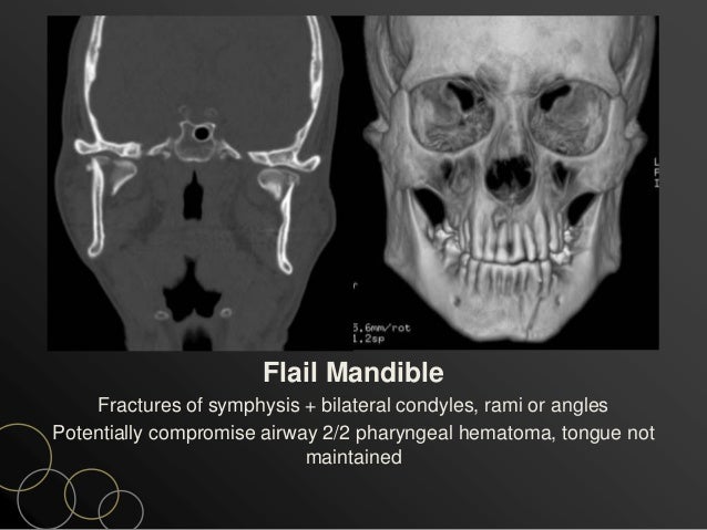 20160925 ser dr.rathachai kaewlai