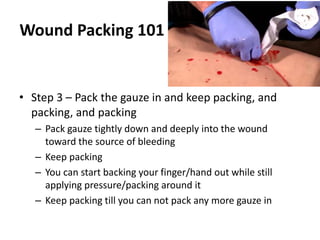 2016 10 06 wound packing 101 | PPTX
