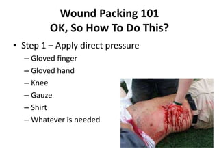 2016 10 06 wound packing 101 | PPTX