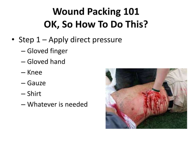 2016 10 06 wound packing 101 | PPTX