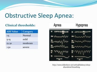 Quantified Sleep - Science behind the sleep trackers | PPT