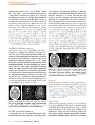 Akinetic mutism after subarachnoid haemorrhage | PDF