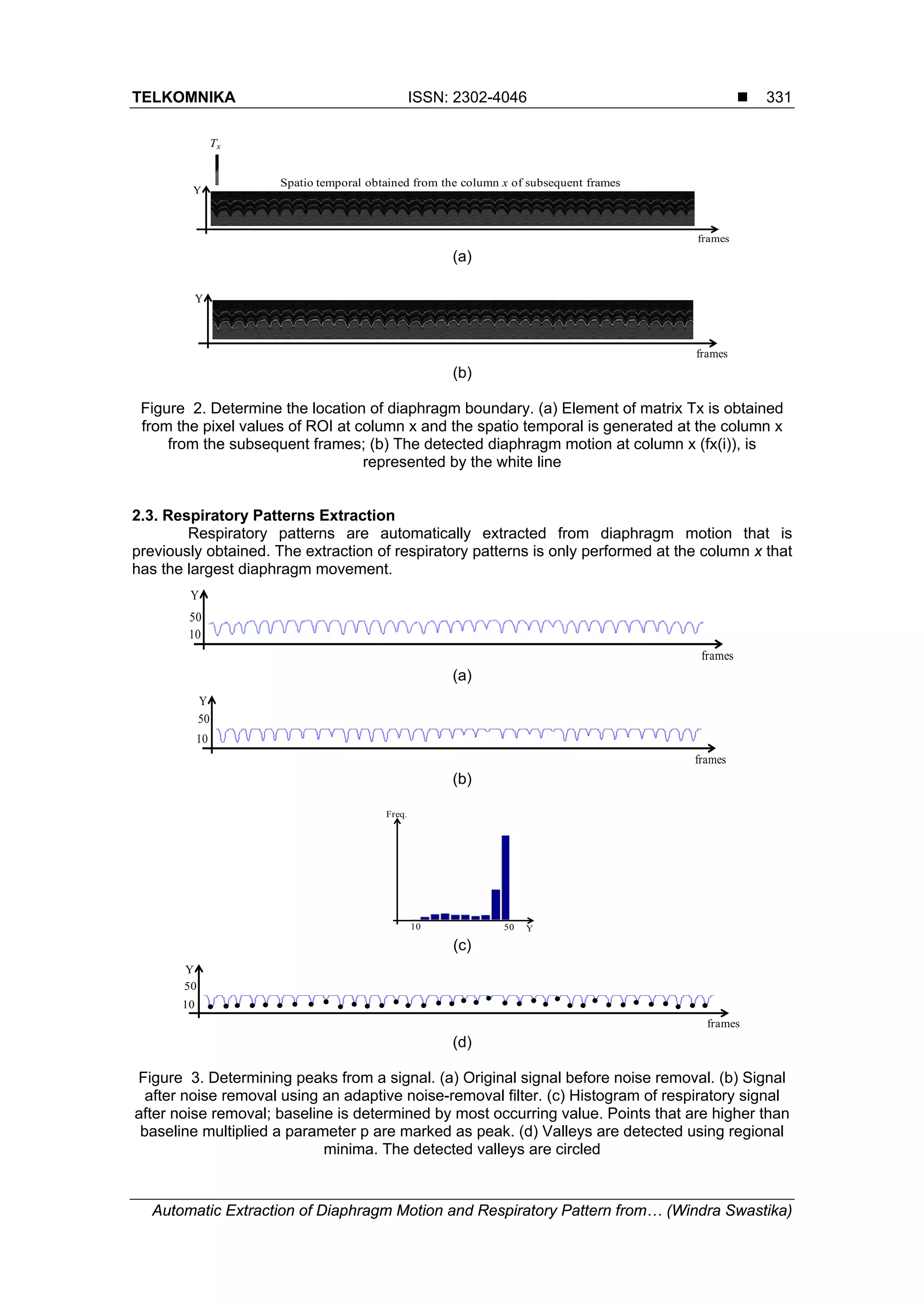 Automatic Extraction of Diaphragm Motion and Respiratory Pattern from Time-sequential Thoracic ...