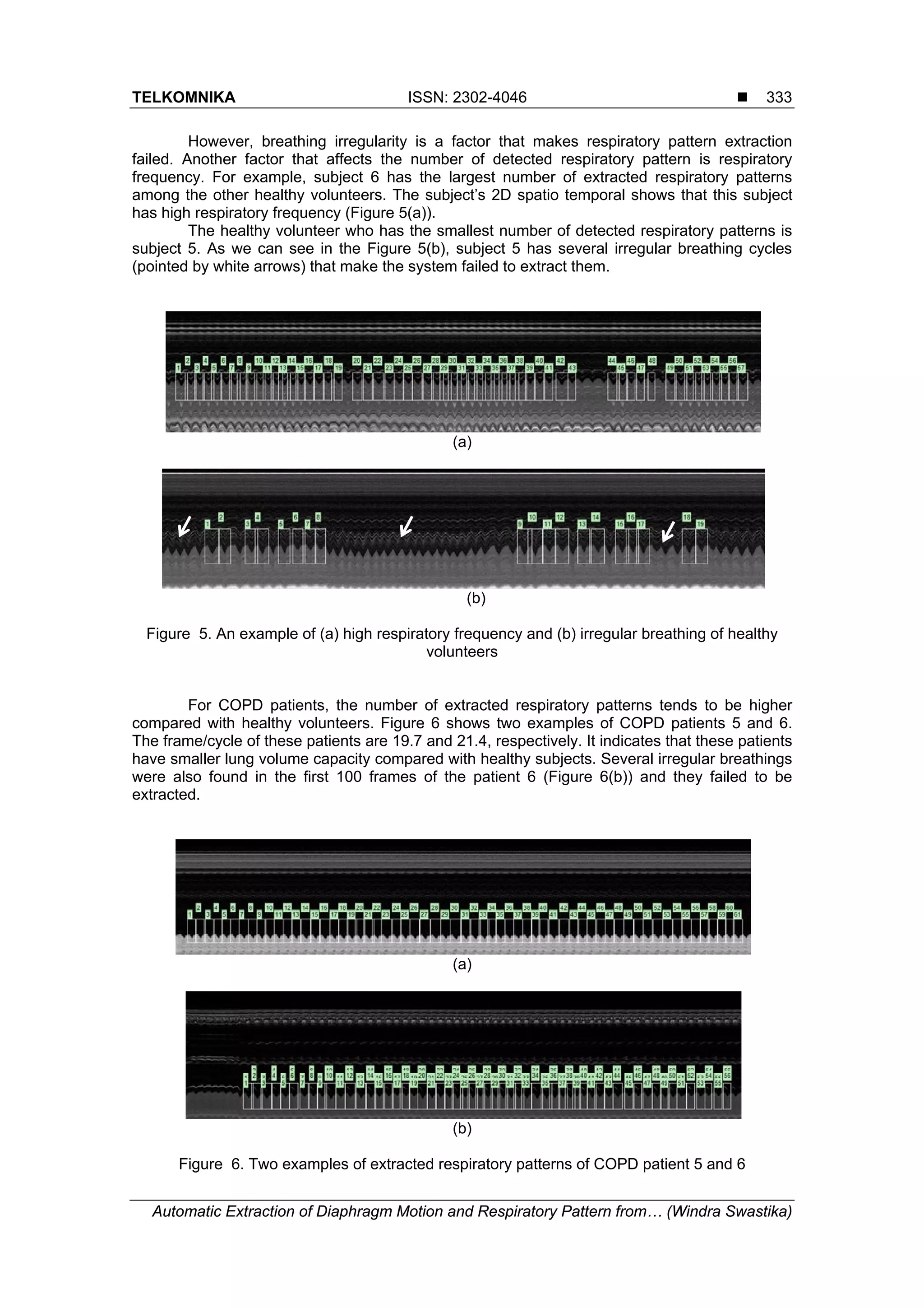 Automatic Extraction of Diaphragm Motion and Respiratory Pattern from Time-sequential Thoracic ...