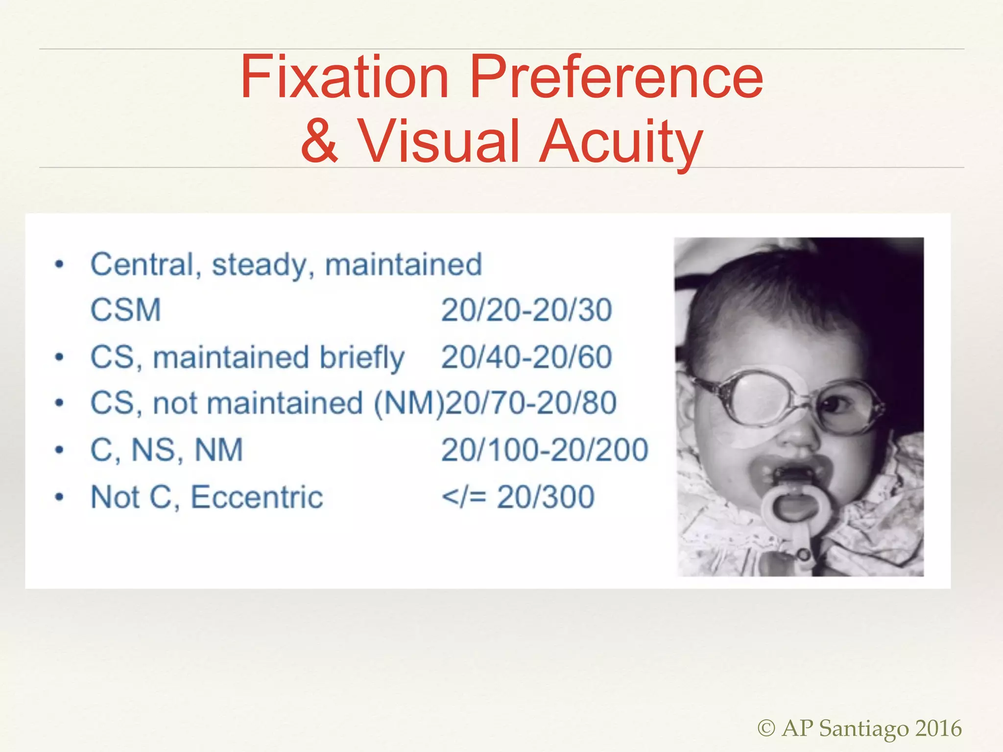 2016 asmph strabismus & amblyopia | PPT