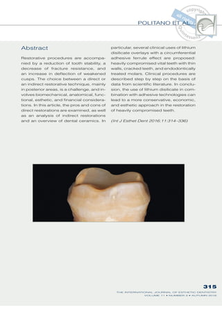 2016 bonded partial ceramic restorations.pdf