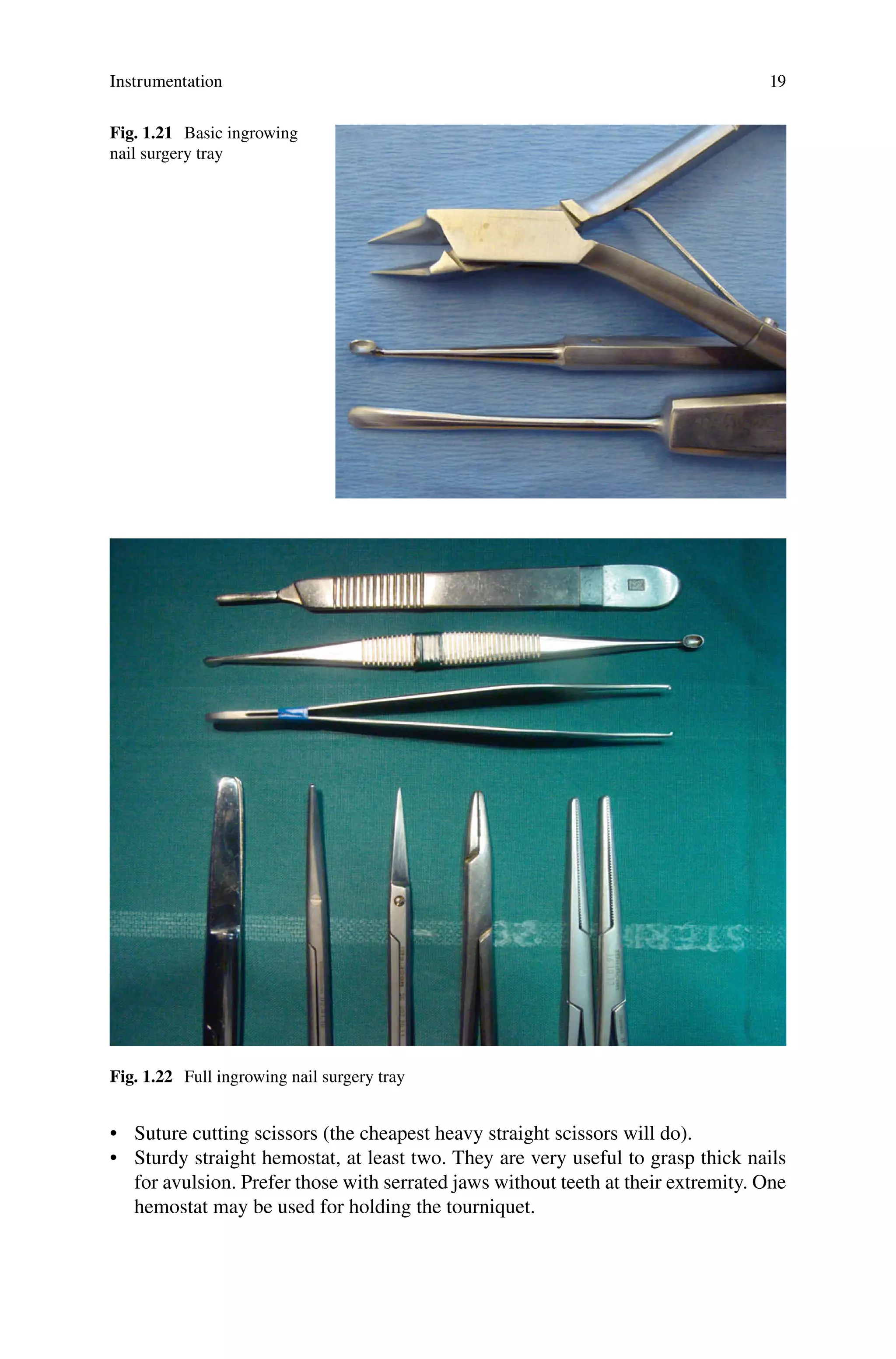2016 book management of ingrowing nails | PDF