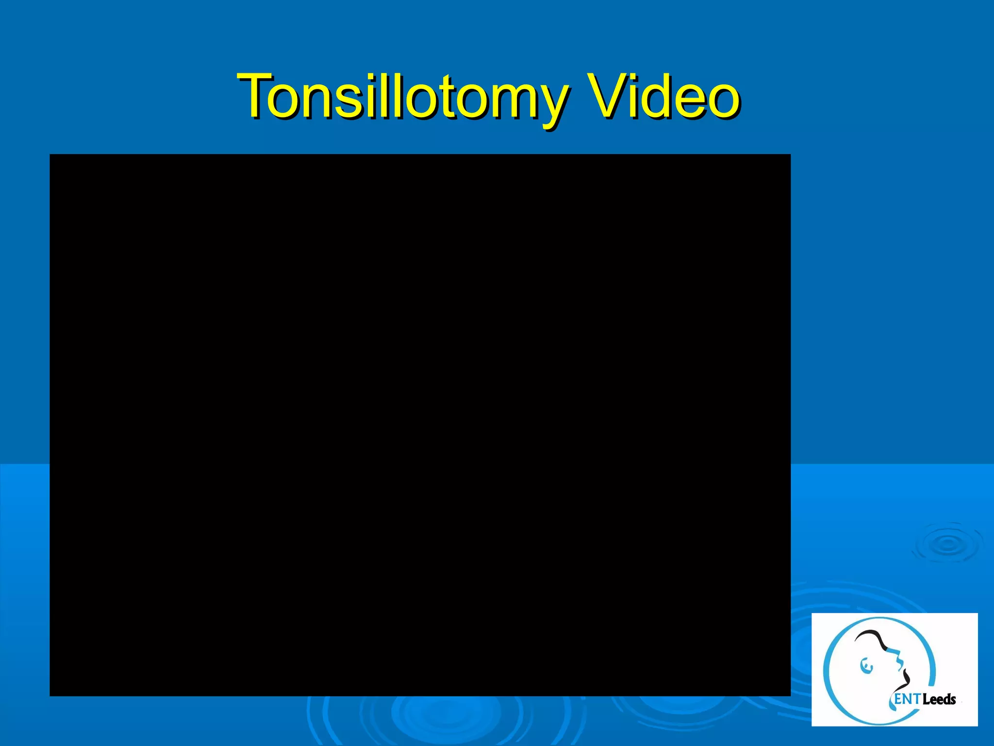 2016 Leeds Coblation Tonsillectony Course | PPT