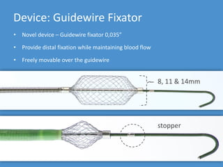 Pre-cannulated f/b-EVAR using guidewire fixator | PPT