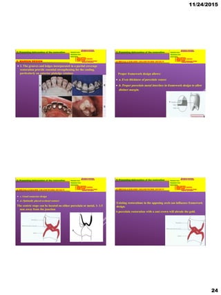 2016 dr ghazy handout of principles of tooth preparations | PDF