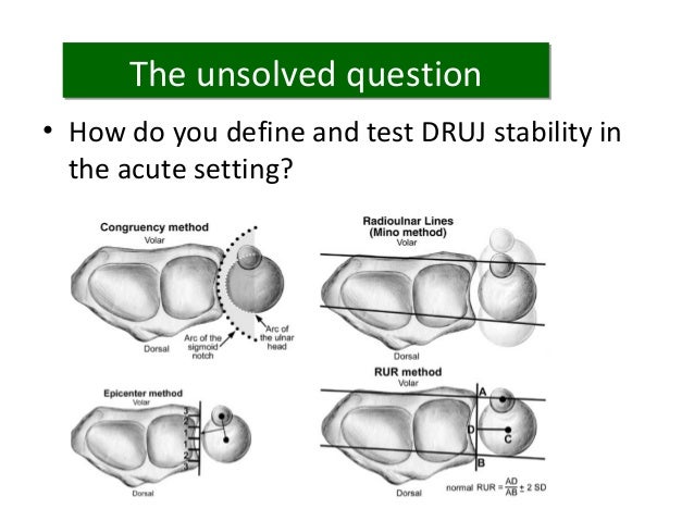 Οξεία Αστάθεια της Άπω Κερκιδωλενικής 016/ Acute DRUJ Instability 016