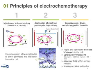Electrochemotherapy : principles, sessions, case studies, and machines ...