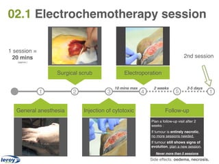 Electrochemotherapy : principles, sessions, case studies, and machines ...