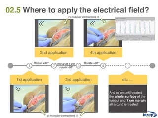 Electrochemotherapy : principles, sessions, case studies, and machines ...