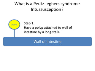 2016 may. version c. pearls in the management of pjs | PPT
