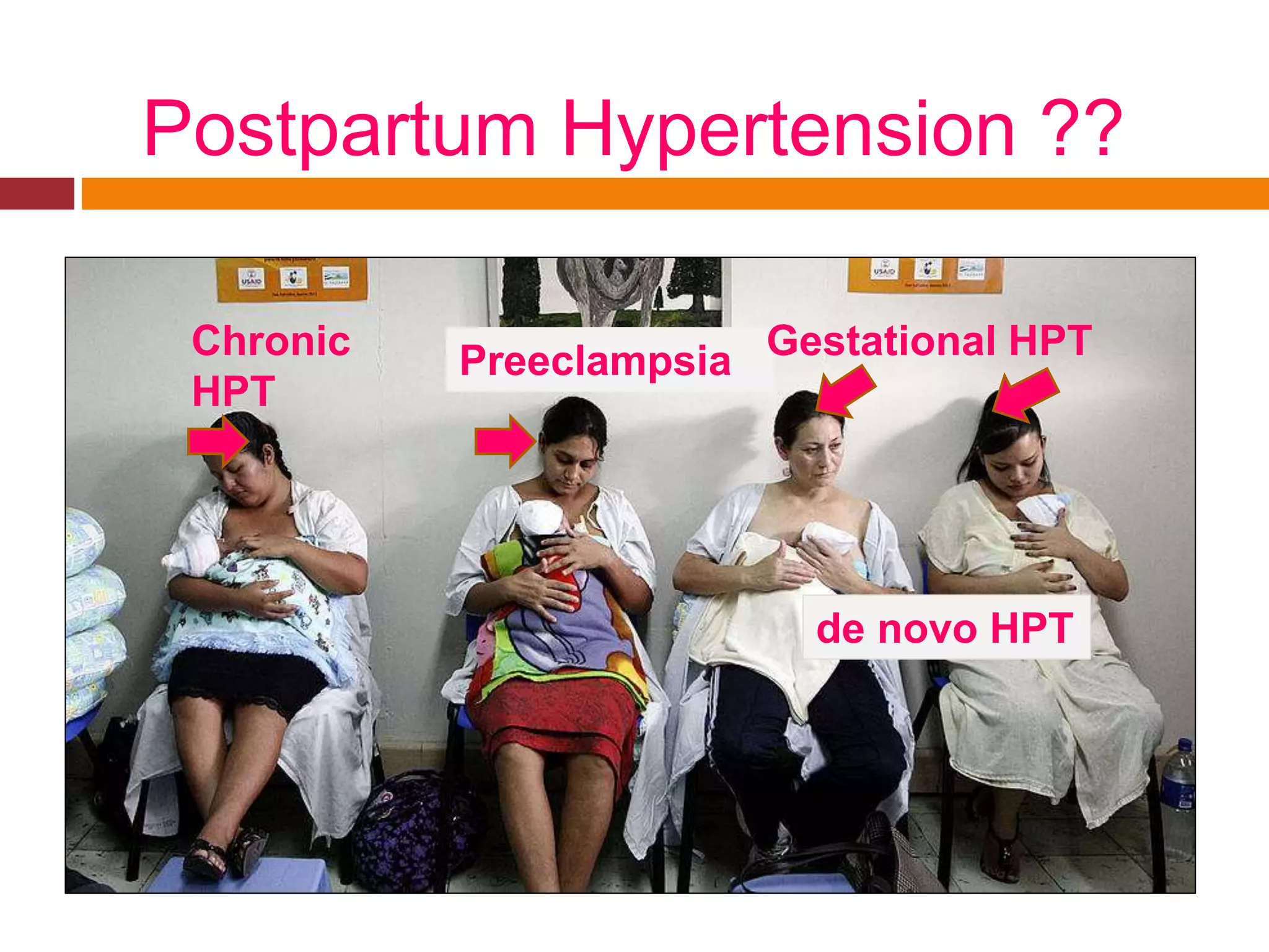 Management of Postpartum Hypertesion | PPTX | Pregnancy | Reproductive ...