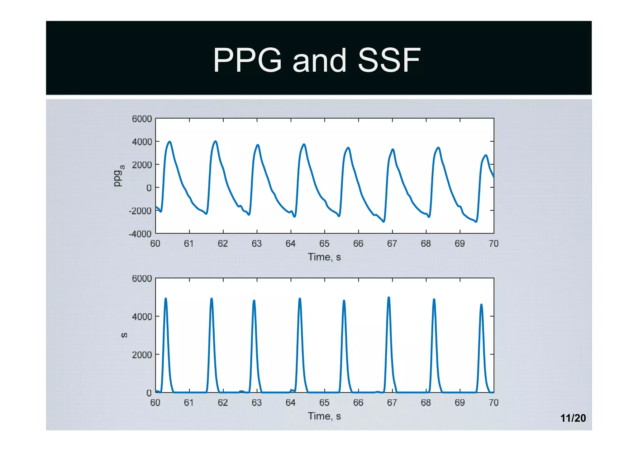Photoplethysmography Based System For Atrial Fibrillation Detection During Hemodialysis Ppt