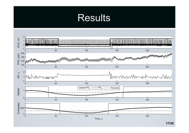 Photoplethysmography Based System For Atrial Fibrillation Detection During Hemodialysis Ppt