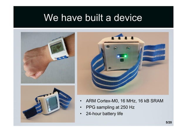 Photoplethysmography Based System For Atrial Fibrillation Detection During Hemodialysis Ppt