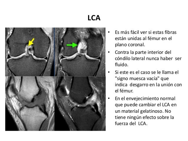 Introducción a la Resonancia Magnética Músculo Esquelética: Quiroprax…