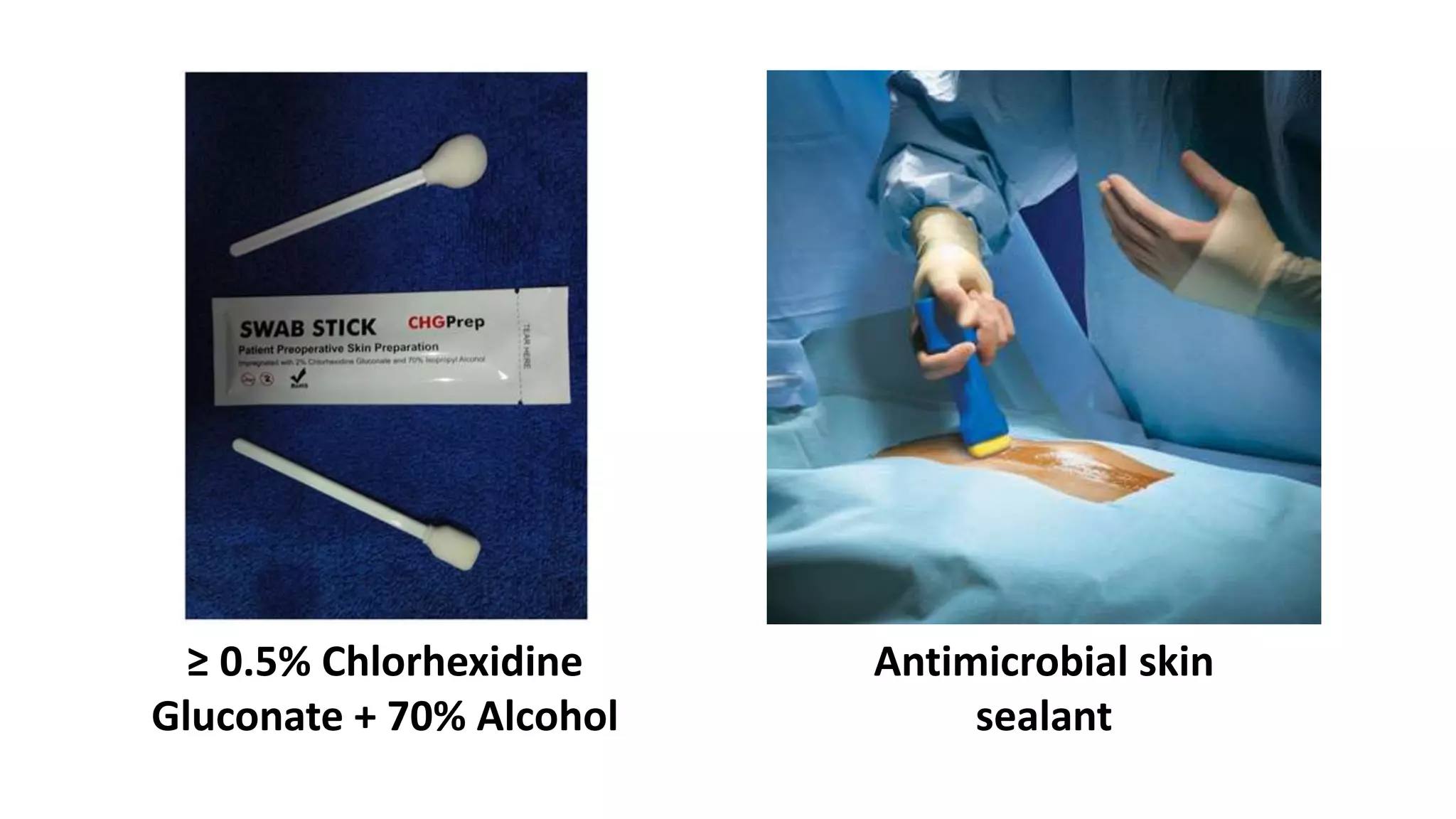 2016 WHO Guidelines on the Prevention of Surgical Site Infection (SSI ...