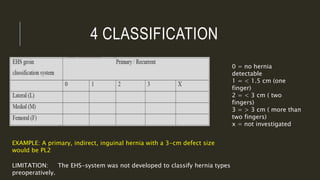 2016 world guidelines for groin hernia management: The HerniaSurge ...