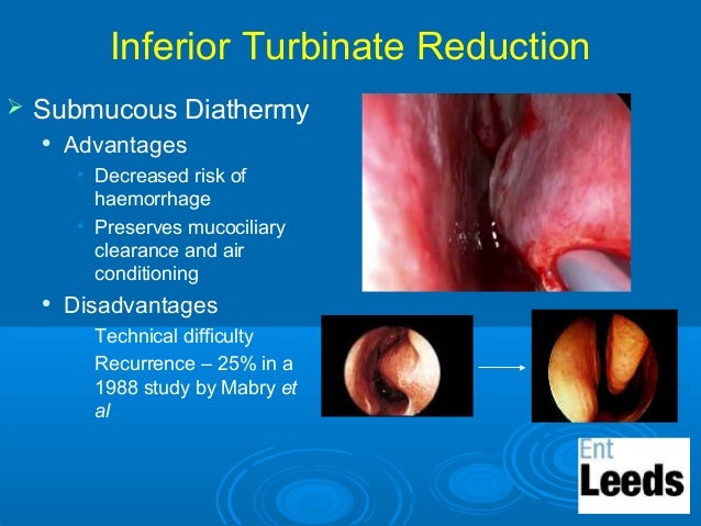 Presentation to GPs at Yorkshire Clinic May 2016