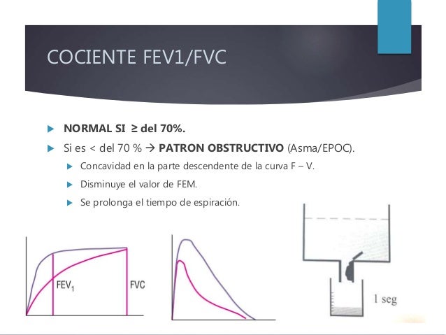 (2017-01-25)espirometria.ppt