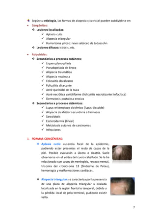 (2017 02-23)alopecia introducción, clasificación y diagnóstico(ppt) | DOCX