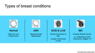 DCIS: What You Need to Know | PPTX