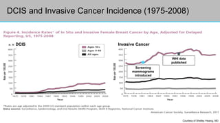 DCIS: What You Need to Know | PPTX