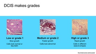 DCIS: What You Need to Know | PPTX