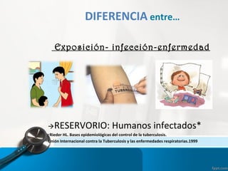(2017 06-08)tuberculosis(ppt) | PPT
