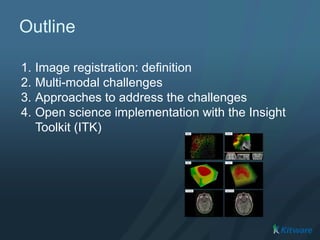 PyData - Multi-dimensional, Multi-modal Image Registration | ODP | Physics | Science