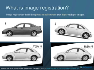PyData - Multi-dimensional, Multi-modal Image Registration | ODP