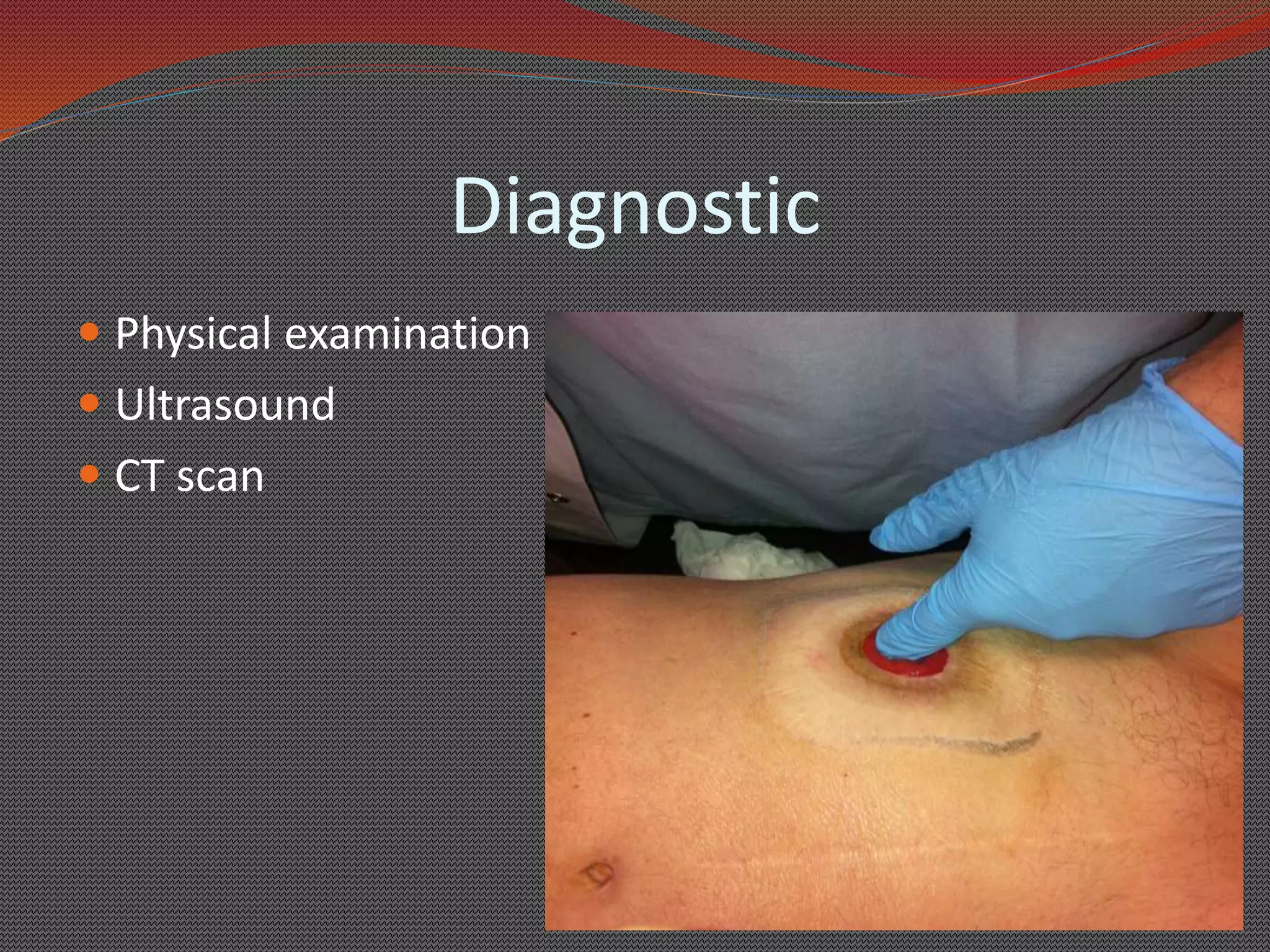 2017.parastomal hernia in colorectal cancer | PPTX