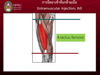 การให้ยาฉีด | PDF