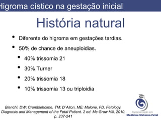 Higroma Cístico no Primeiro Trimestre - Mariana Rialto | PPTX