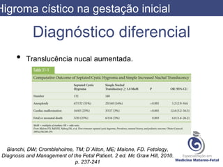 Higroma Cístico no Primeiro Trimestre - Mariana Rialto | PPTX