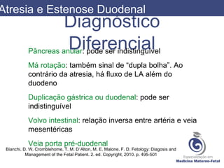 Atresia e Estenose Duodenal - Beatriz Vargas | PPTX