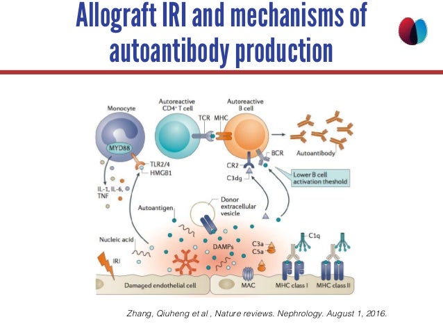 Acute Allograft rejection in kidney transplantation 2017 Chaken