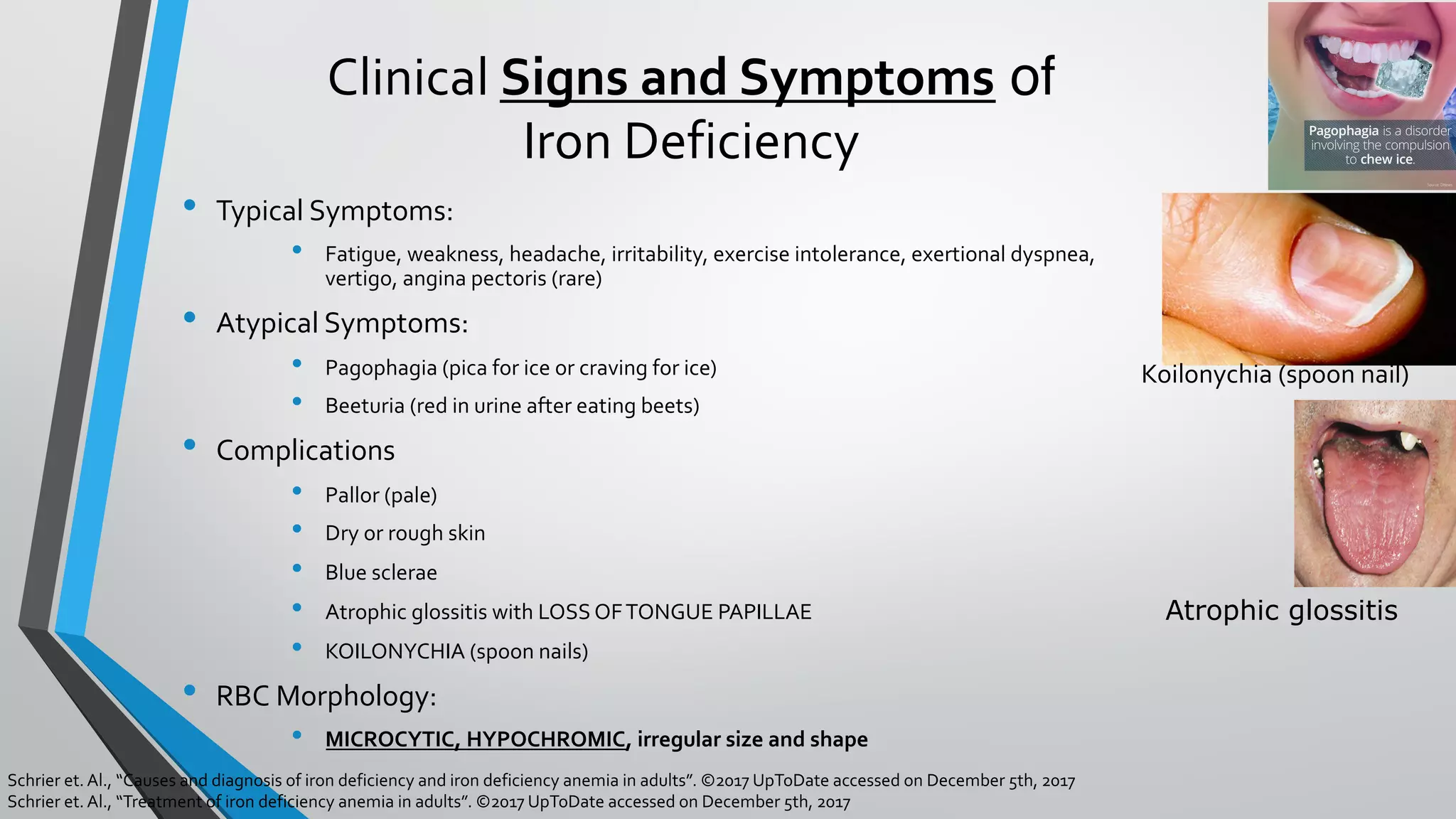 Treatment of Iron Deficiency Anemia in Adults | PDF