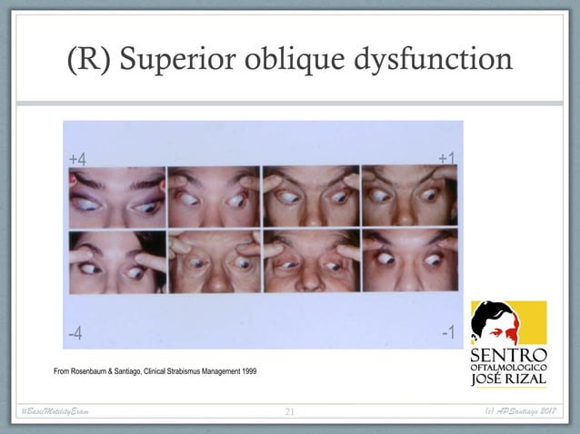 2017 Basic Motility Examination | PDF | Eye and Vision Conditions ...