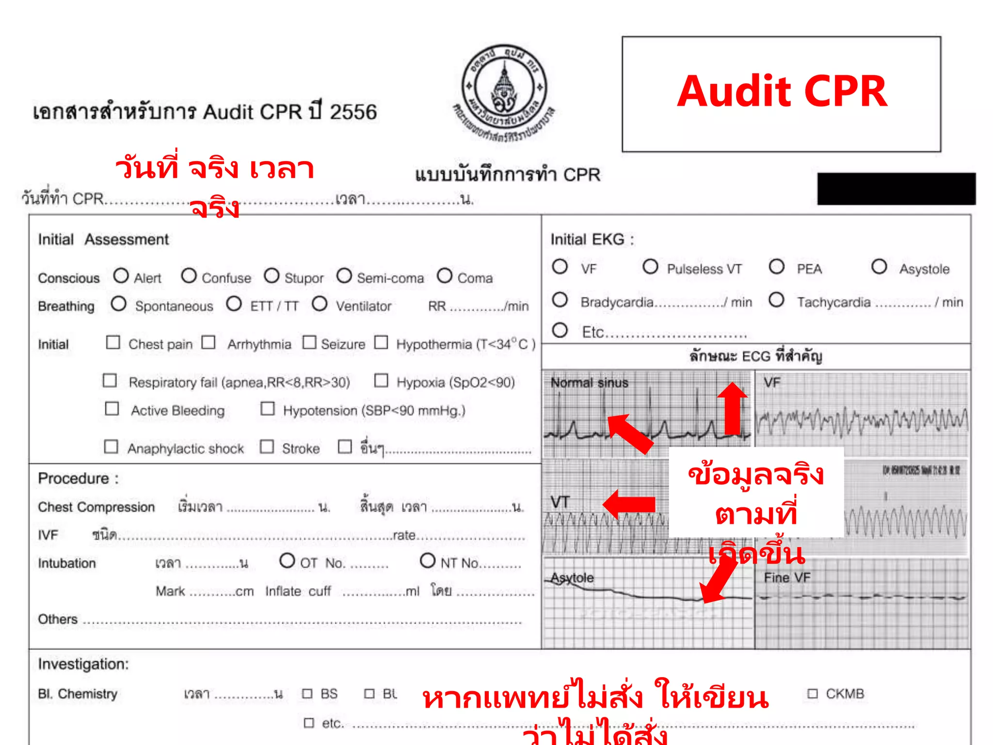 2017 CPR audit | PPSX