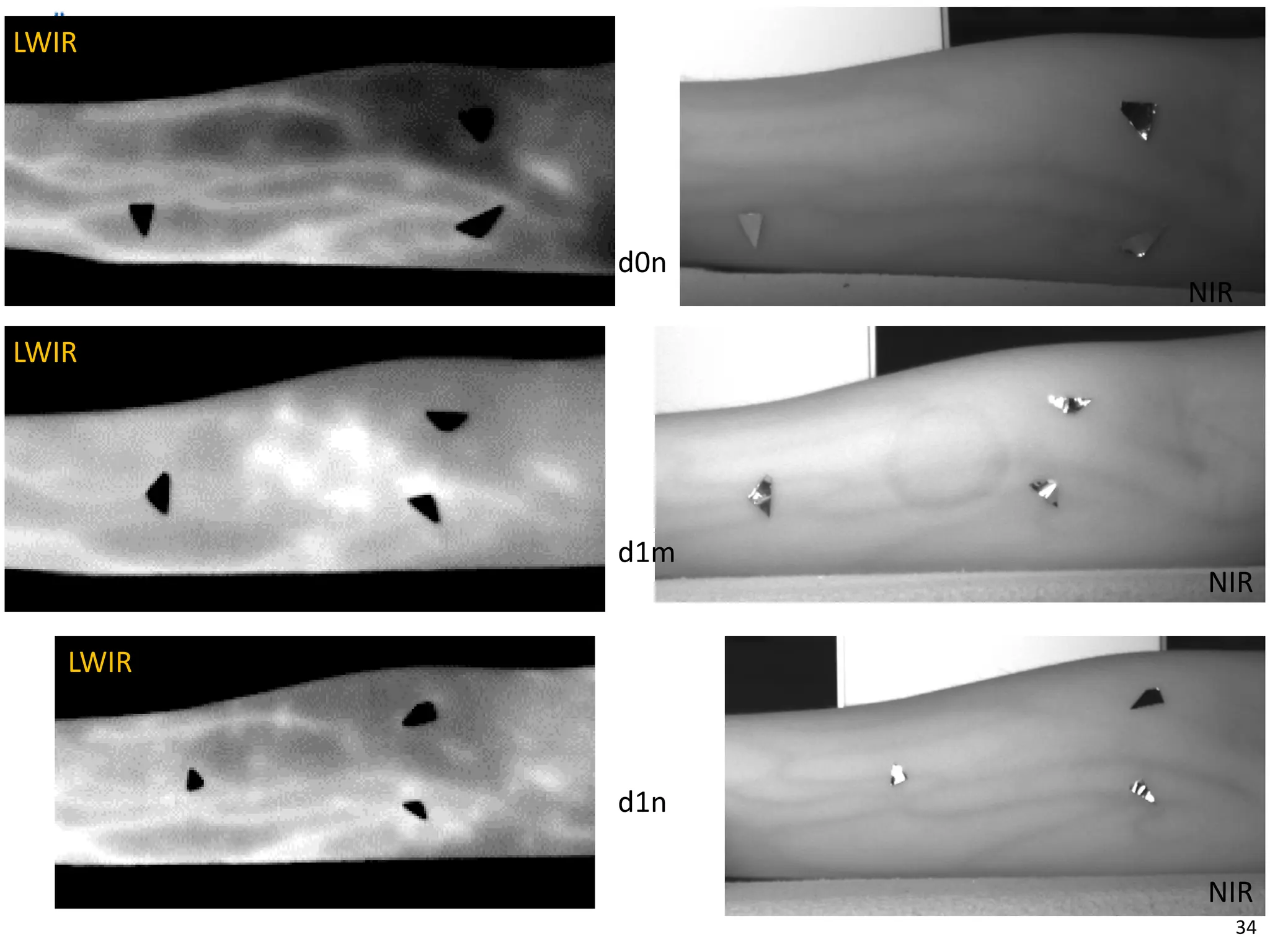 Hyperspectral imaging of bedsore and a simulation study for wound ...