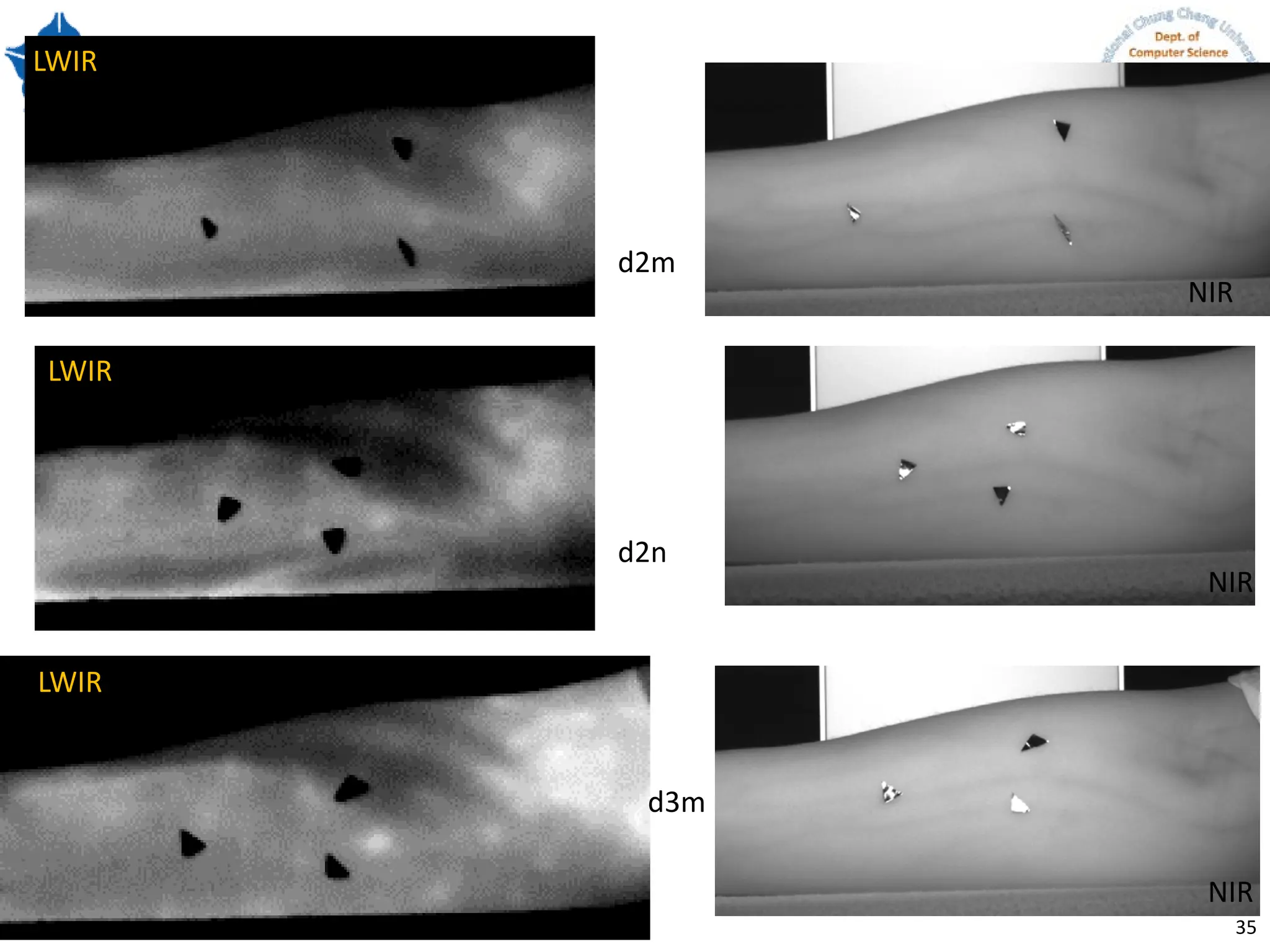 Hyperspectral imaging of bedsore and a simulation study for wound ...